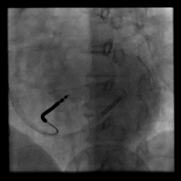 最美技法｜CRT网络新晋赛【适应证专题月】——新晋达人篇（三） -- 严道脑血管网