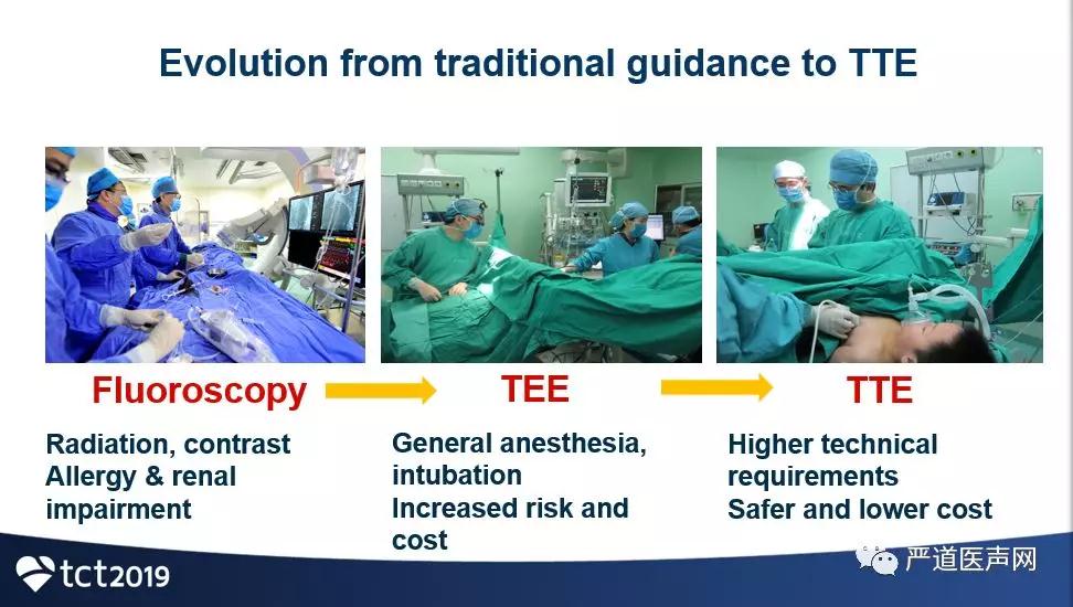 TCT2019中国之声｜潘湘斌：简化卵圆孔未闭封堵中国经验 -- 严道脑血管网