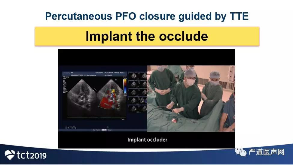 TCT2019中国之声｜潘湘斌：简化卵圆孔未闭封堵中国经验 -- 严道脑血管网