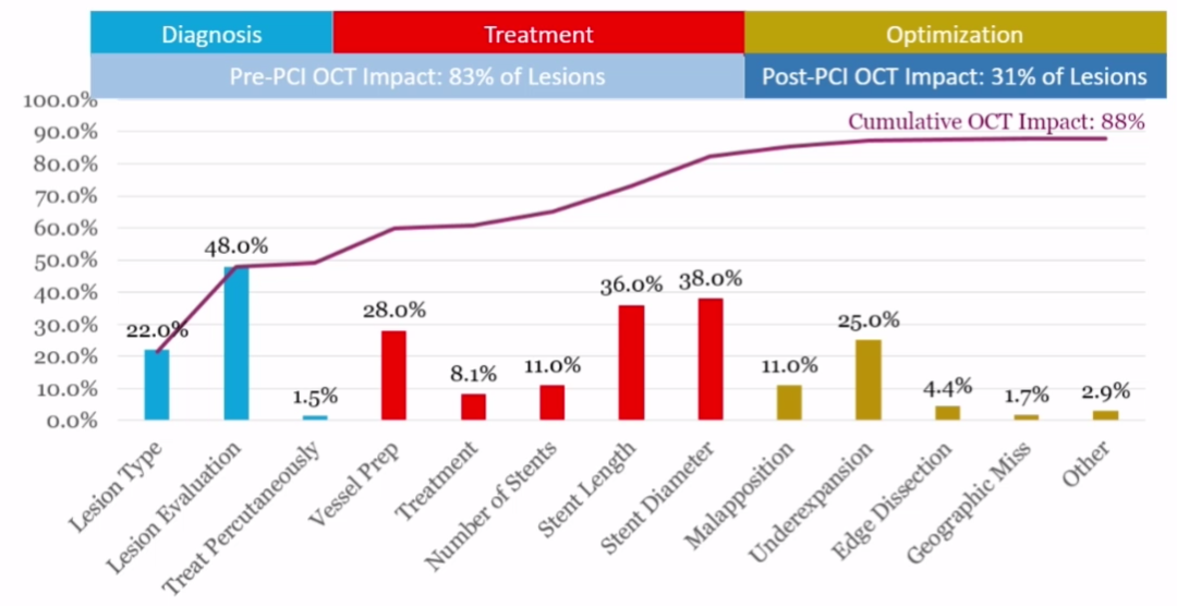 EuroPCR 2020 LIGHTLAB研究：OCT影响PCI决策制定 -- 严道脑血管网