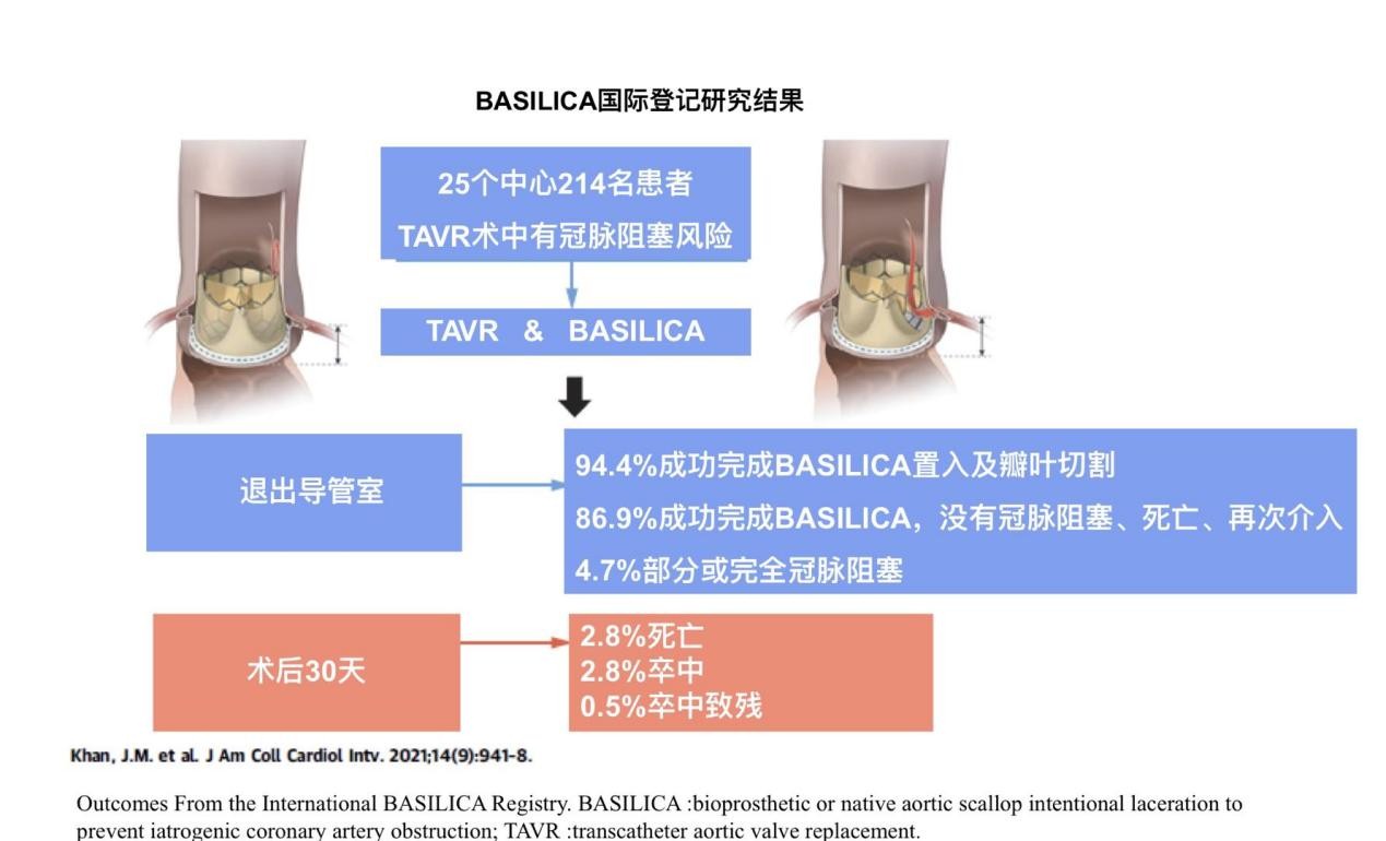 文献速递 | BASILICA用于预防TAVR冠脉阻塞 -- 严道脑血管网