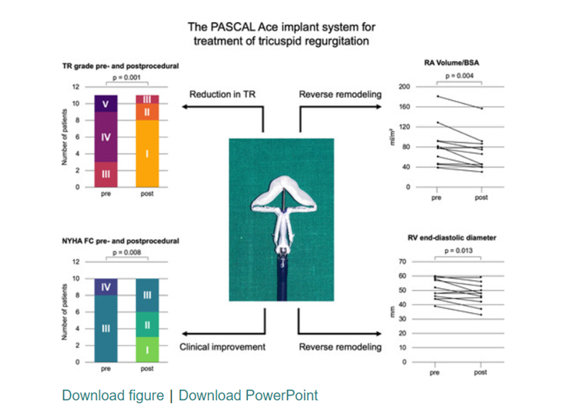 文献速递 | 经导管PASCAL ACE植入可改善重度TR患者的临床状态及右心重塑 -- 严道脑血管网