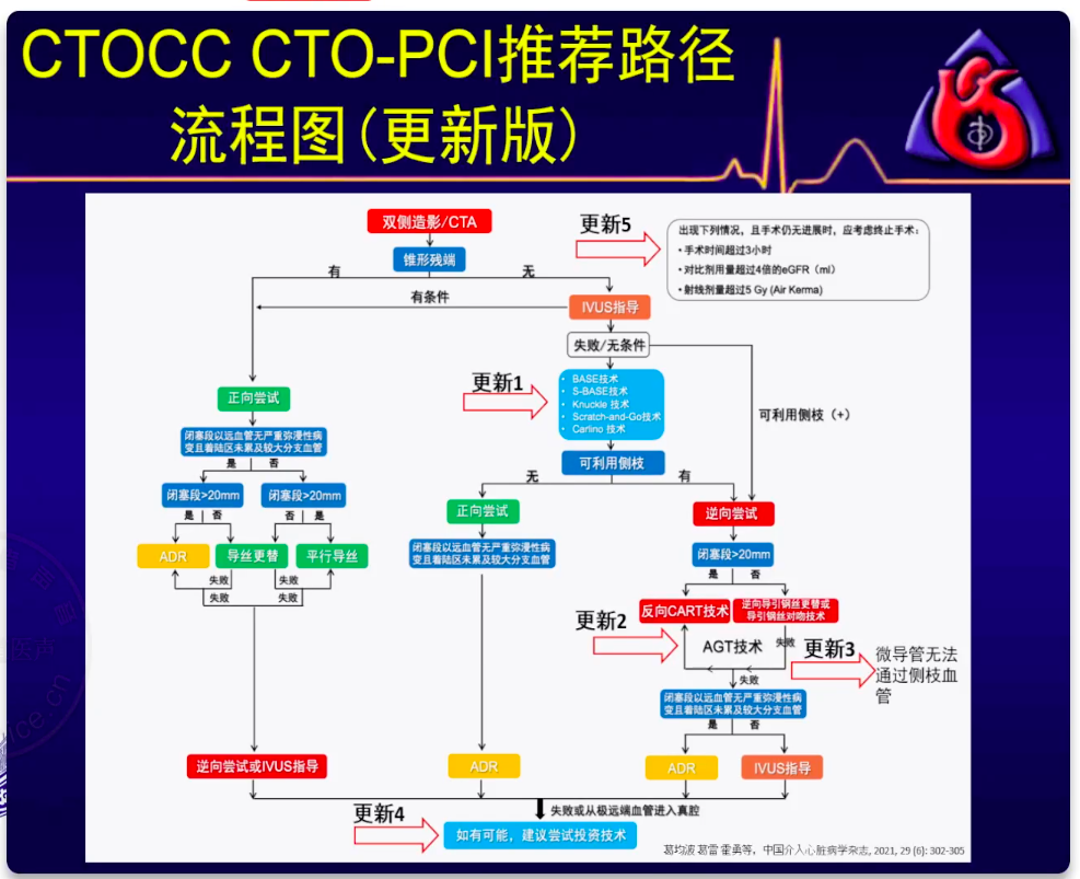 CTOCC 2021 | 葛均波：CTOCC CTO PCI推荐路径更新与新器械的选择 -- 严道脑血管网